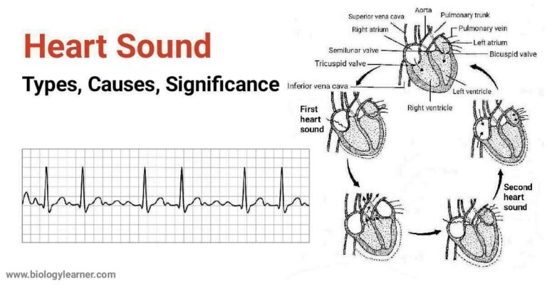 Heart Sound: Types, Causes, and Significance